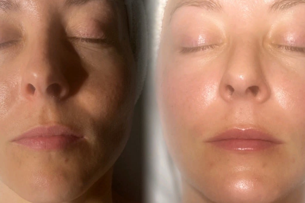 VERABELLA Skin Therapy Spa: Read Reviews and Book Classes on ClassPass