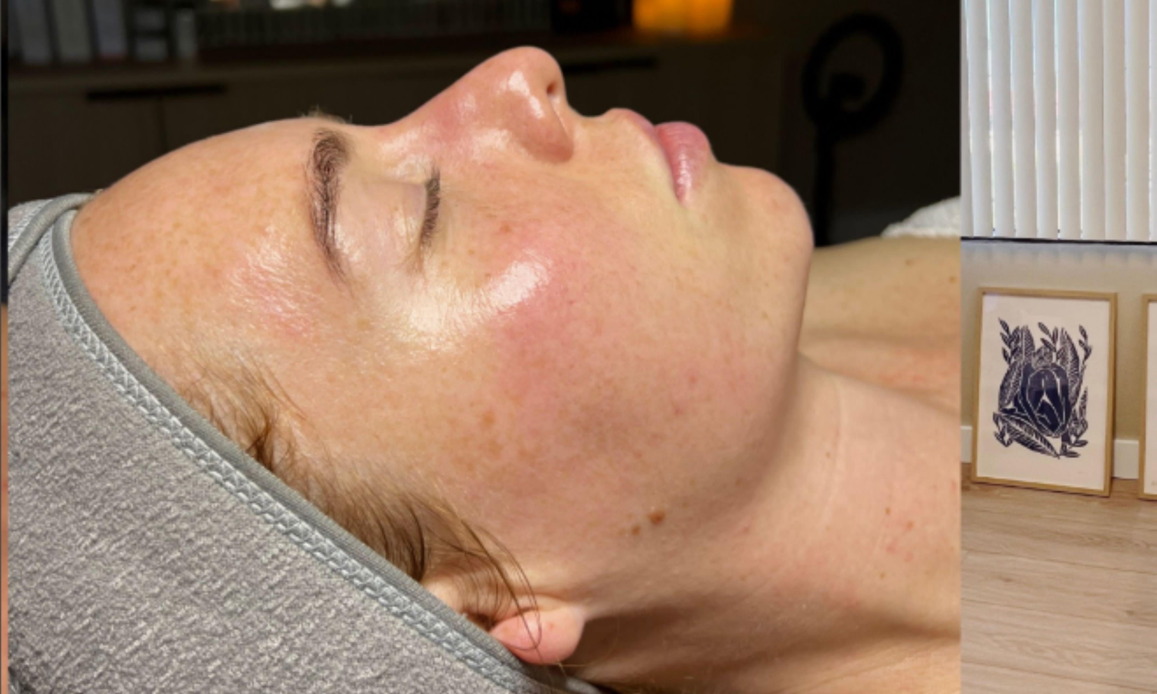 Emma Howard Aesthetics: Read Reviews and Book Classes on ClassPass