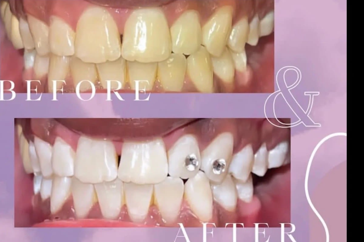 Photo Ready Smile: Read Reviews and Book Classes on ClassPass