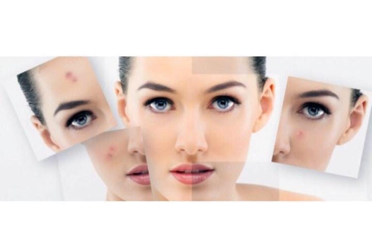 DermaMiracle Aesthetics Center: Read Reviews and Book Classes on ClassPass