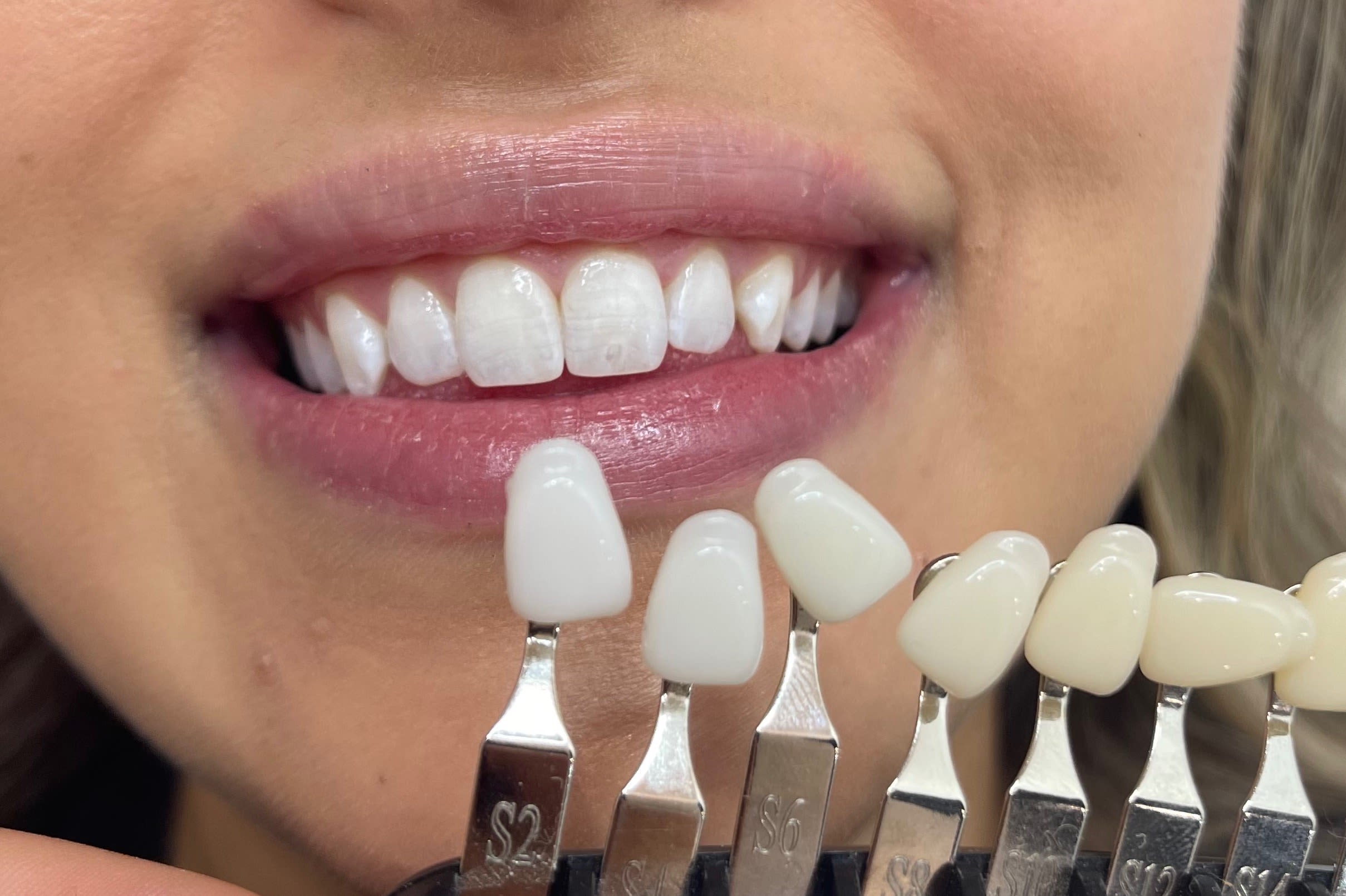 Pretty pearly whites: Read Reviews and Book Classes on ClassPass